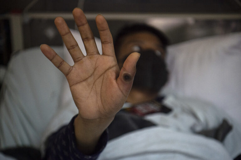 Monkeypox is health emergency in Africa. EU ready to donate 215,000 ...